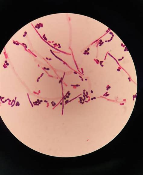 120 Staphylococcus Saprophyticus Fotos Stockfotos Afbeeldingen En