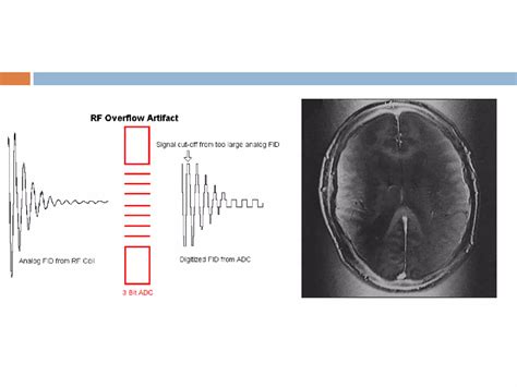 Mri Artifacts Pptx