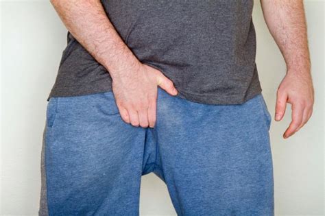 Jock Itch Causes Treatments And Remedies Medical News Today