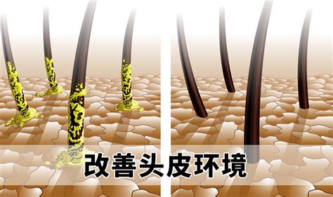 头发爱出油和饮食油腻有关系吗吃的油腻头发就会出油吗 知乎