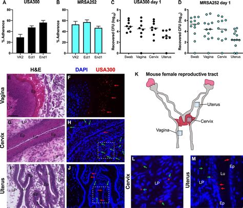 Identification Of Key Determinants Of Staphylococcus Aureus Vaginal Colonization Mbio