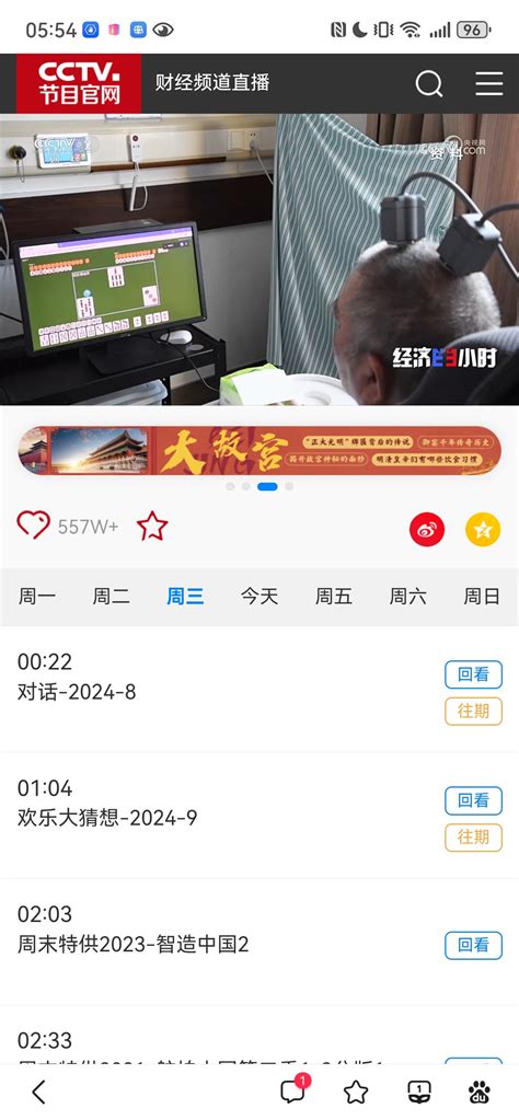 脑机接口改变人类创新医疗目前是唯一参与该技术的上市公司 财富号 东方财富网