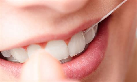 Recuperação pós cirurgia plástica gengival tempo e cuidados