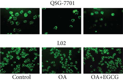 Effects Of Egcg On The Autophagy Of Oa Treated Qsg 7701 And L02 Cells