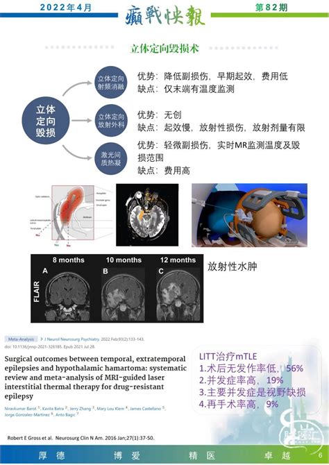 【癫战快报】第82期：专题 药物难治性颞叶癫痫的外科治疗趋势 脑医汇