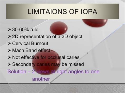Iopa Interpretationppt