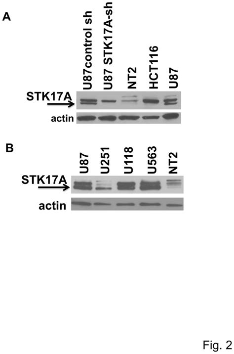Stk17a Protein Is Overexpressed In Gbm Cells Lines Compared To Nt2d1