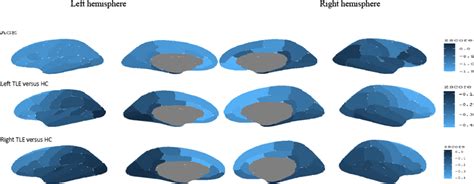 Posterior Z Scores Ie The Ratio Of The Posterior Mean And Standard
