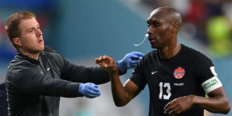 World Cup 2022 Canada Captain Puts Tampon Up Nose In Game Business