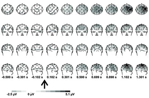 A Scalp Voltage Topography Of Oldnew Difference Collapsed Across