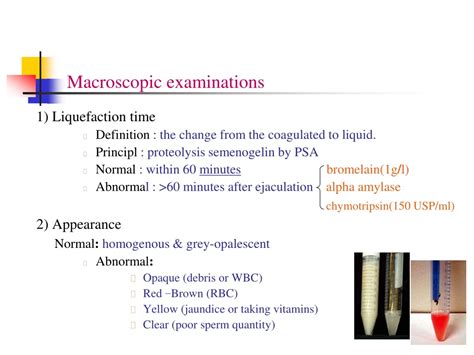 Ppt Semen Analysis And Sperm Processing Powerpoint Presentation Id