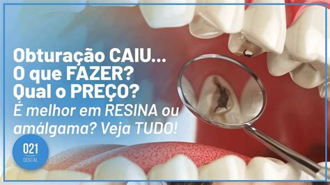 Obturação Do Dente Caiu Retoedu