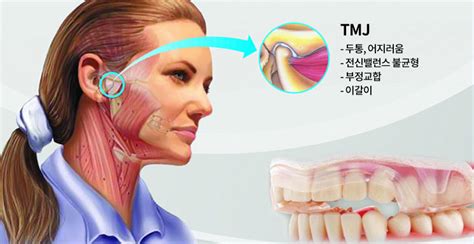 Aqualizer 알푸스부산