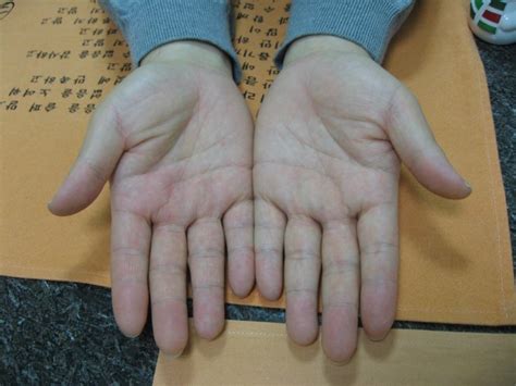 손바닥 색으로 보는 건강 네이버 블로그