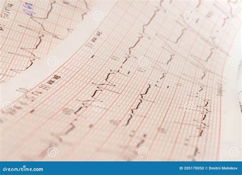 Close Up Of An Electrocardiogram In Paper Form Ecg Or Ekg Record Paper