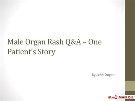 Ppt Male Organ Rash Q Powerpoint Presentation Free Download Id1496226