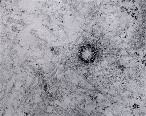 Centrioles Electron Micrograph