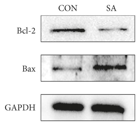 Sa Negatively Regulated Apoptosis Metastasis And The Wnt β Catenin