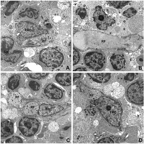 Basement Membrane Extracellular Matrix Protein Immunoelectron