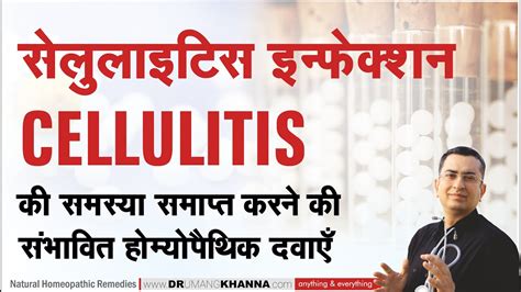 Cellulitis Natural Homeopathic Remedies With Symptoms Youtube