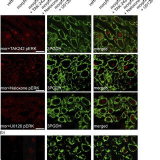 A PERK1 2 Expression In The Neurons And SGCs Of The DRG The Fraction