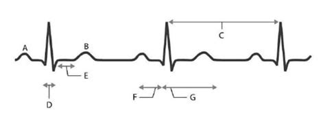 Ecg Waves Segments Or Intervals Diagram Quizlet
