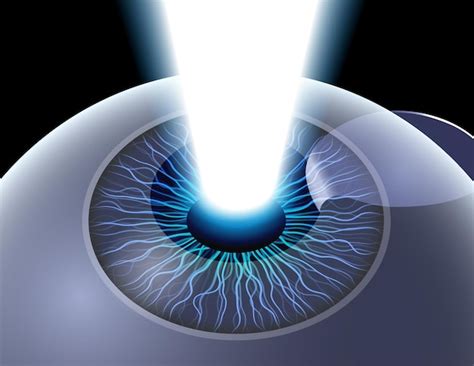 Cirugía Ocular Lasik Vector Premium