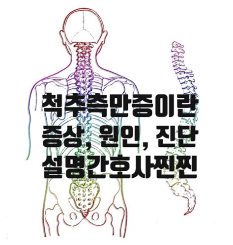 소아 청소년 척추측만증 Scoliosis 척추측만증이란정의증상 원인 네이버 블로그