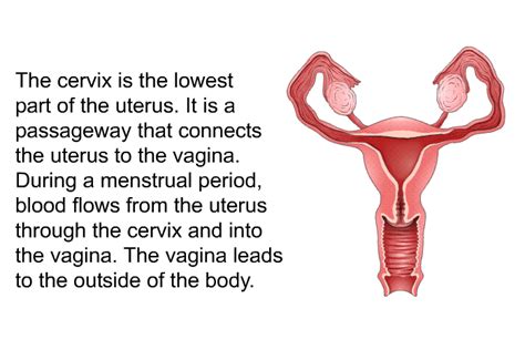 Cervix Disorders