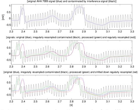 Figure 2 From Power Line Interference Removal From Ecg In Case Of Power Line Frequency