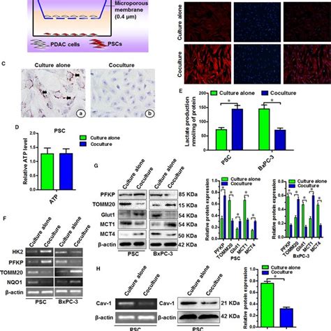 Stroma‐tumour Cell Metabolic Coupling Occurs Under Psc And Pdac
