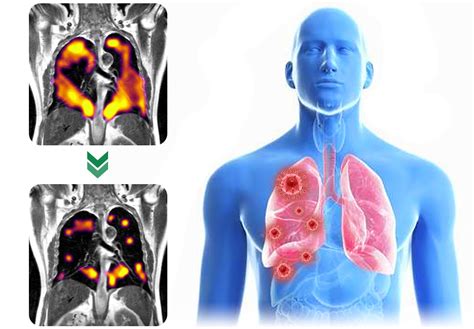 Dobshow™ Freshair Herbal Lung Cleanse Repair Patch