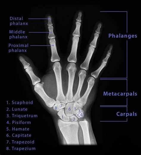 Hand Bones Names Structure With Labeled Diagrams