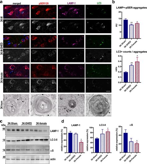 Female Sex And Brain Selective Estrogen Benefit α Synuclein