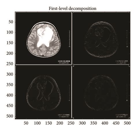 Schematic Of Brain Mri Image By 1 Level Discrete Wavelet Decomposition Download Scientific Diagram