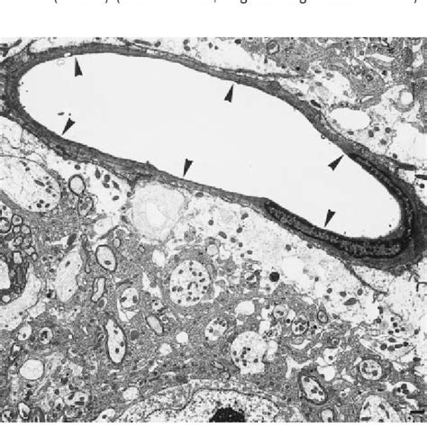 Light Micrograph Of The Left Substantia Nigra Pars Reticulata Shows