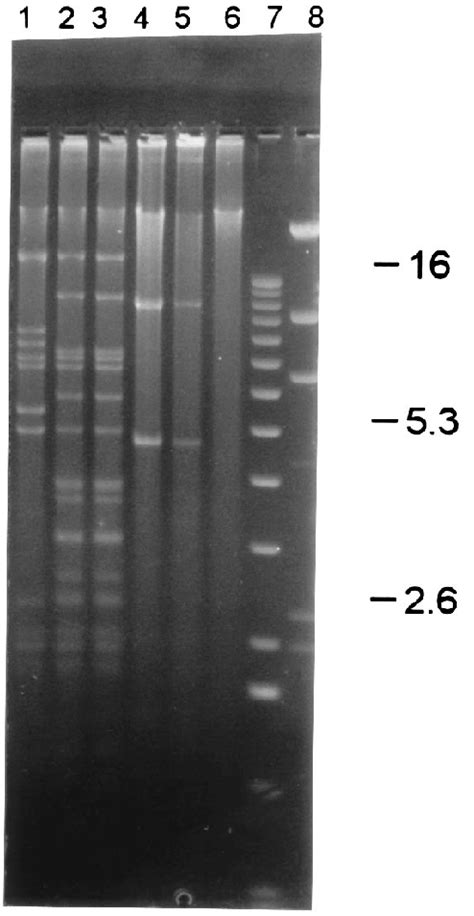 Agarose Gel Electrophoresis Of Plasmid Dna After Digestion With Ecori