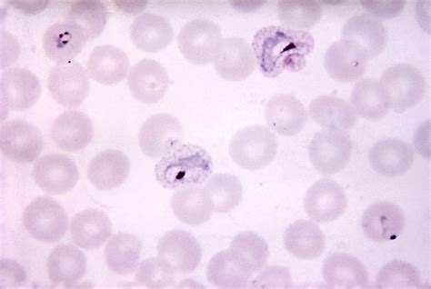 Free Picture Micrograph Plasmodium Vivax Macrogametocyte Distinct