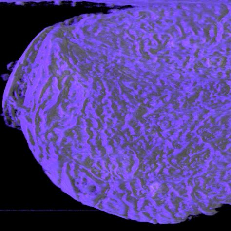 Qbi Image Segmentation Kaggle