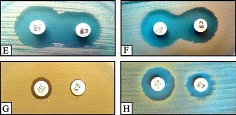 β Lactamases Detection By Double Disc Synergy Test That Employs A Download Scientific Diagram