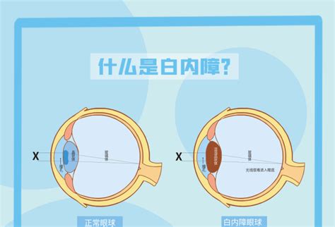 眼健康海报在线编辑 什么是瞳孔 图司机