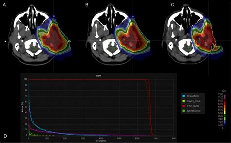 Step And Shoot Spot Scanning Proton Arc Therapy Sparc Chinmaya Ias