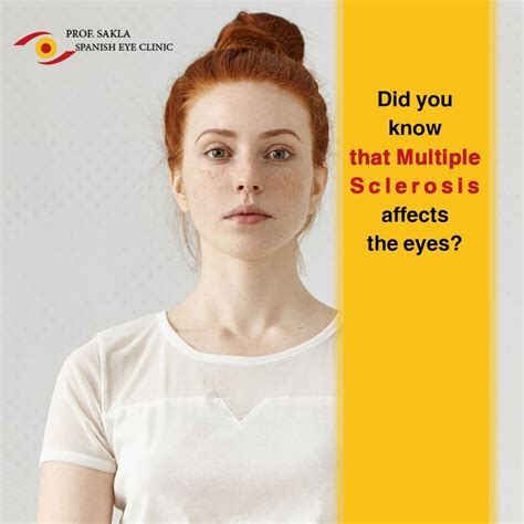 How Does Ms Affect The Eyes 👁 Double Vision 👁 Blurred Vision 👁 Optic Neuritis 👁 Nystagmus