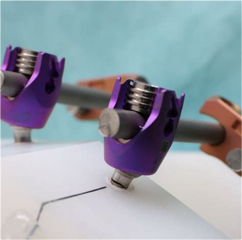 Typical Failure Mode Of A Cobalt Chromium Rod Construct Screw Breakage