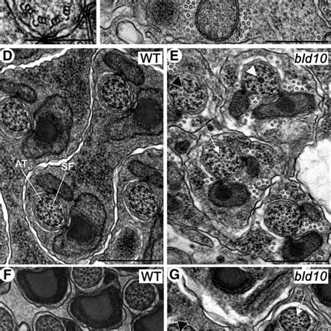 Bld10 Mutant Centrioles And Basal Bodies Are Short Wild Type And