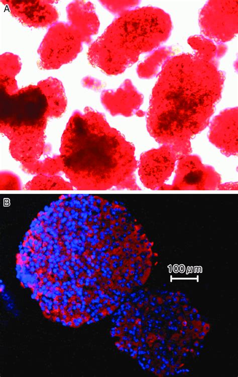 Isolated Mouse Islets A Islets Stained With Dithizone Dtz Sigma Download Scientific Diagram