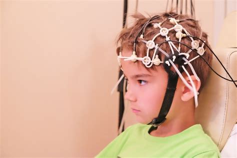 Badanie Eeg Głowy Dziecka