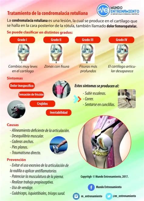 Condromalacia rotuliana 1 propuesta práctica en interior