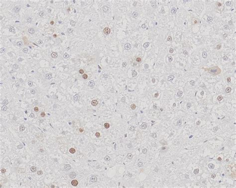 免疫組織化学染色【p】 株バイオ病理研究所