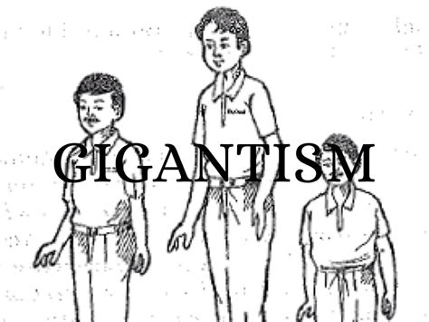 Gigantism By Darian Shastwell